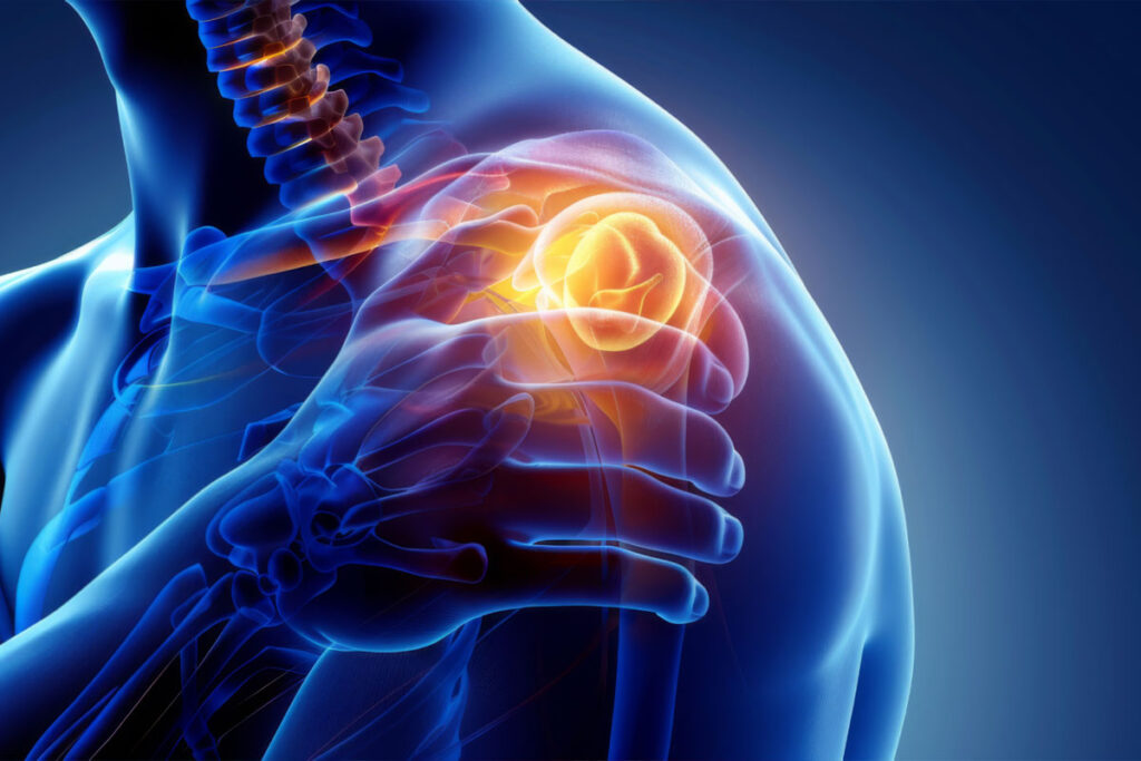 Shoulder Pain – Dynamic Spine & Neuropathy: Chiropractor in Sioux Falls