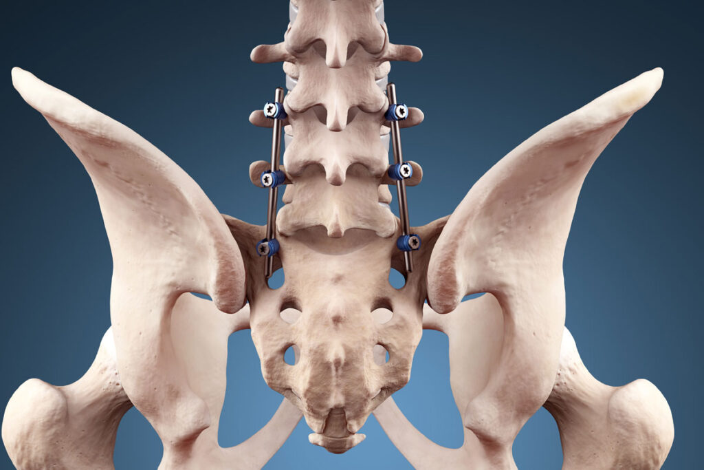 Jason’s Story – Pelvic Alignment – Dynamic Spine & Neuropathy ...